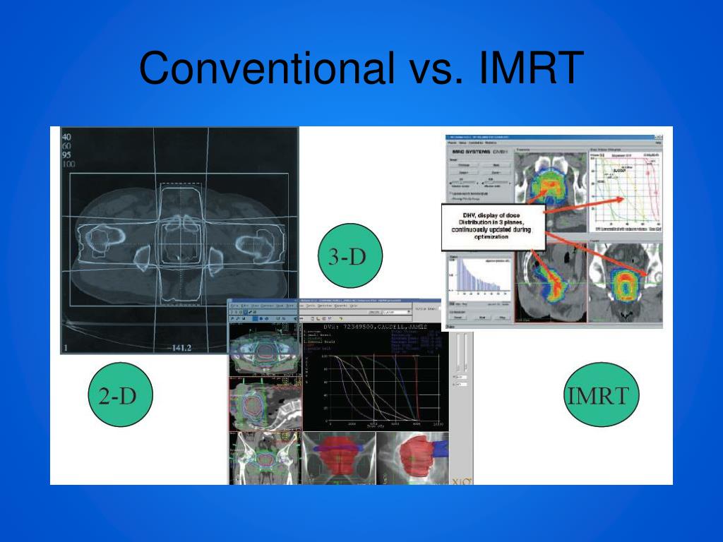 PPT - Radiation Therapy in Prostate Cancer Current Status and New ...