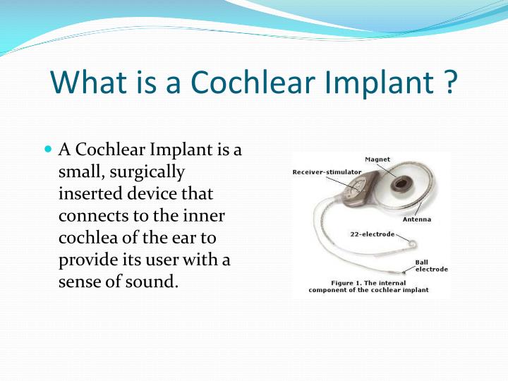 PPT - Cochlear Implants PowerPoint Presentation - ID:2753099