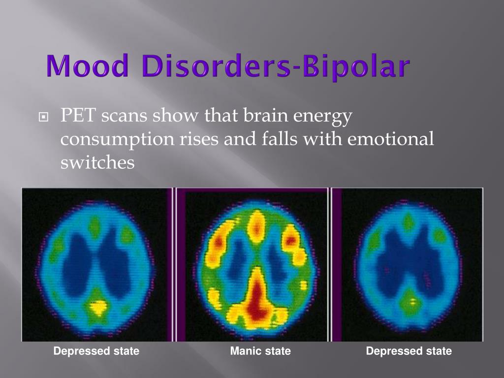 PPT - Bipolar Disorder: The High Rate of Misdiagnosis PowerPoint ...