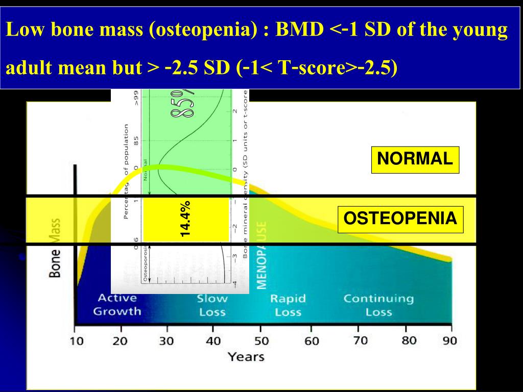 PPT - Osteoporosis Diagnosis by DEXA and Ultrasound Measurement ...