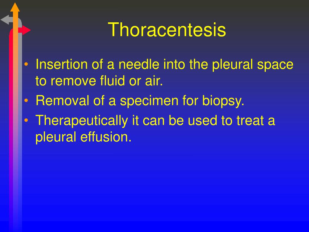 PPT - Pleural Diseases Kyphoscoliosis PowerPoint Presentation, free ...