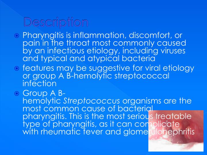PPT - Pharyngitis PowerPoint Presentation - ID:2761712