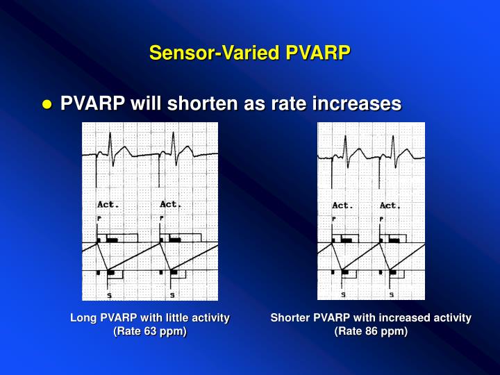 PPT - Pacemaker Timing and Intervals PowerPoint Presentation - ID:2764991