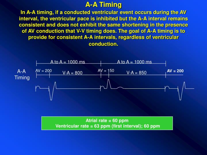 PPT - Pacemaker Timing and Intervals PowerPoint Presentation - ID:2764991