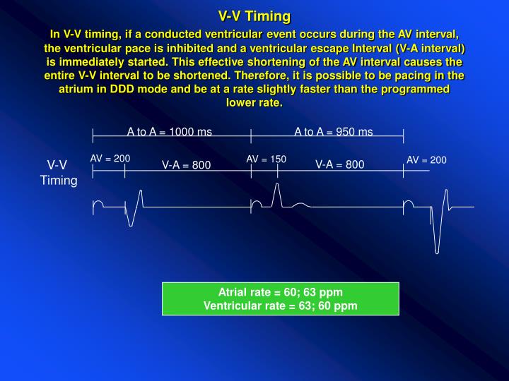 PPT - Pacemaker Timing and Intervals PowerPoint Presentation - ID:2764991