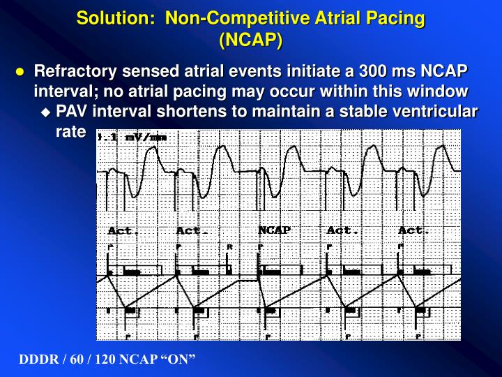 PPT - Pacemaker Timing and Intervals PowerPoint Presentation - ID:2764991