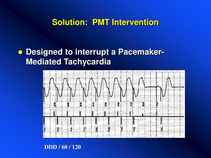 PPT - Pacemaker Timing and Intervals PowerPoint Presentation - ID:2764991