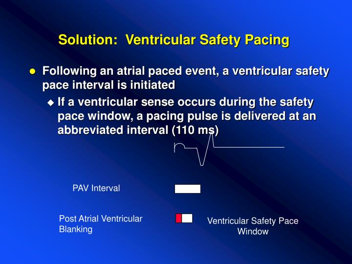 PPT - Pacemaker Timing and Intervals PowerPoint Presentation - ID:2764991