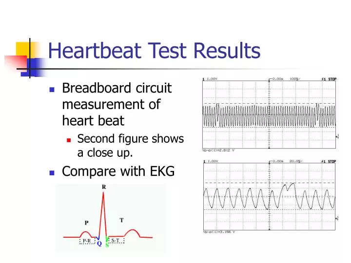 PPT - Heartbeat Test Results PowerPoint Presentation, free download ...