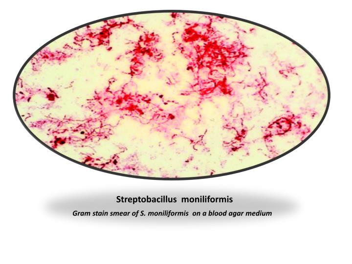 PPT - Rat Bite Fever Project PowerPoint Presentation - ID:2766539