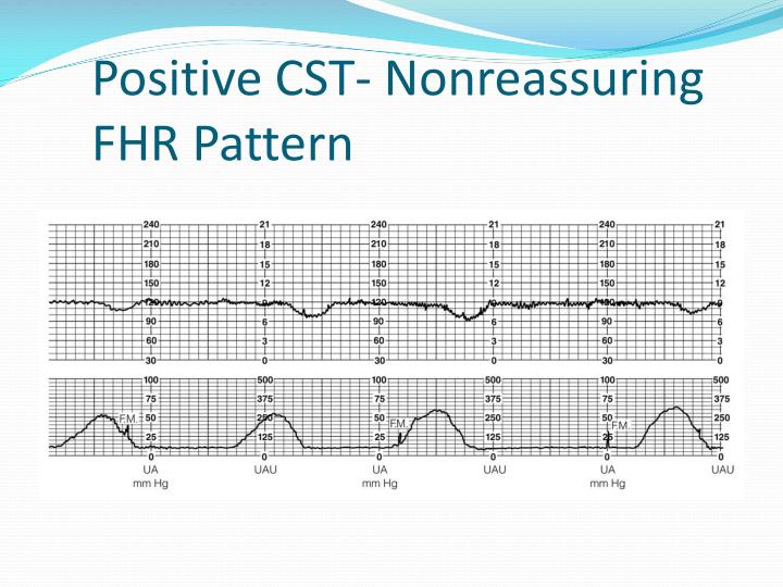 PPT - ANTEPARTAL FETAL ASSESSMENT PowerPoint Presentation - ID:2767336