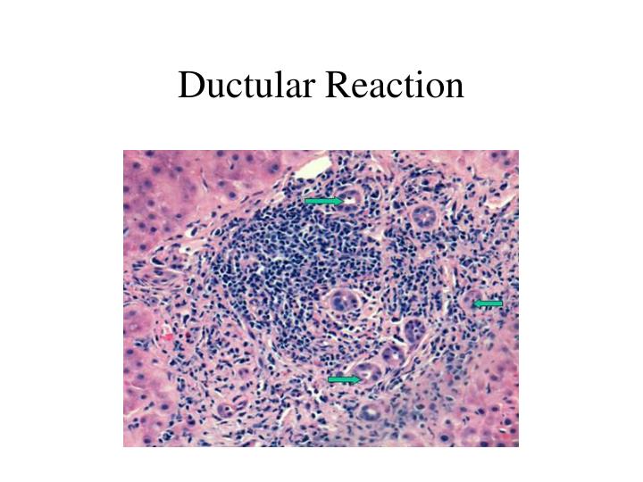 PPT - The Liver PowerPoint Presentation - ID:2768822