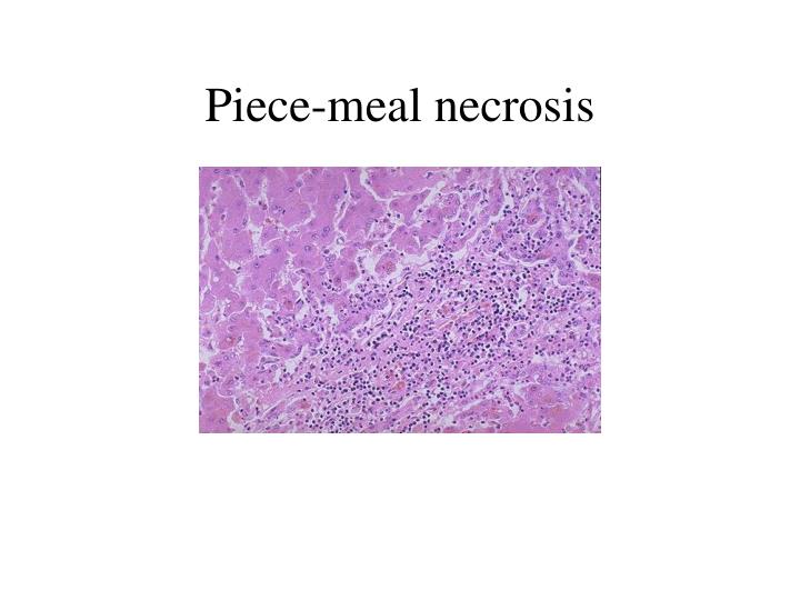 PPT - The Liver PowerPoint Presentation - ID:2768822