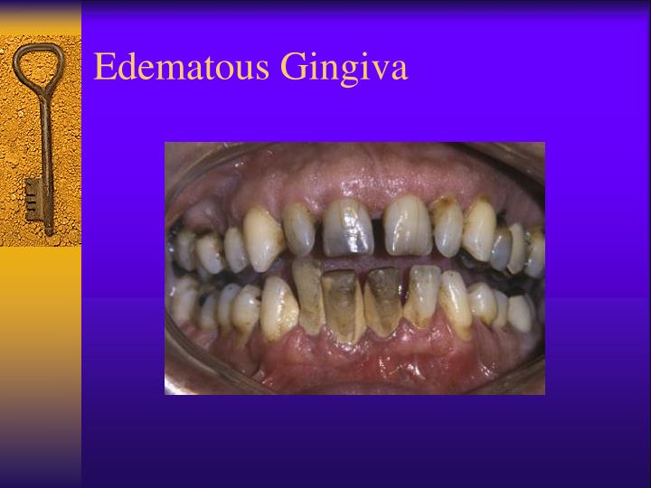 PPT - Overview of the Dentitions PowerPoint Presentation - ID:2769691