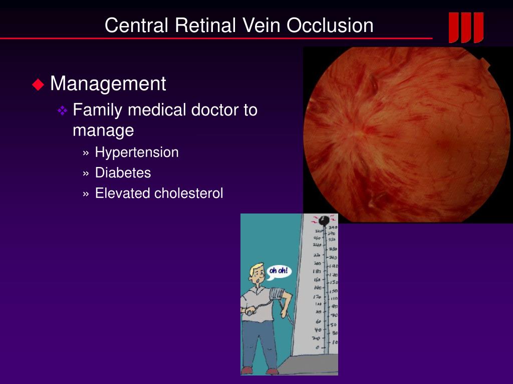 PPT - Arterial and Venous Occlusive Disease of the Retina PowerPoint ...