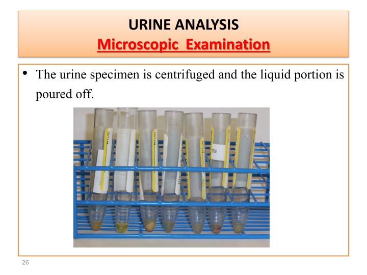 PPT - Urinalysis PowerPoint Presentation - ID:2773692