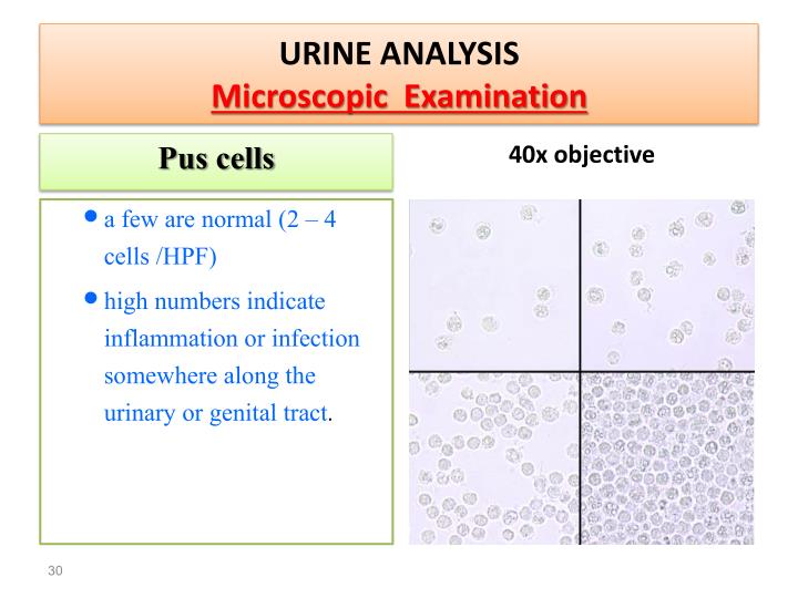 PPT - Urinalysis PowerPoint Presentation - ID:2773692