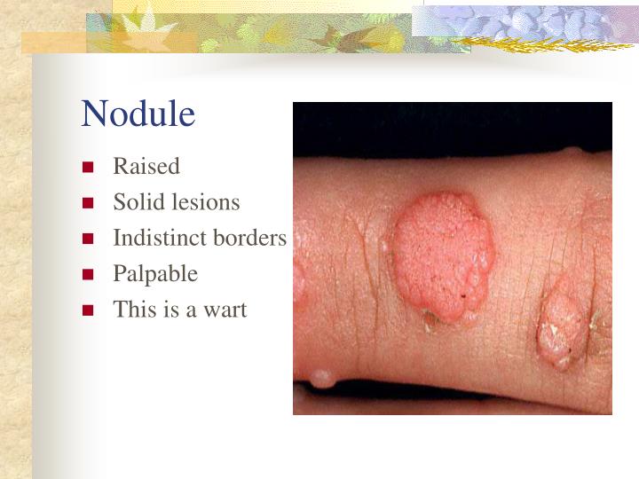 PPT - Rashes and the School Nurse PowerPoint Presentation - ID:2777002
