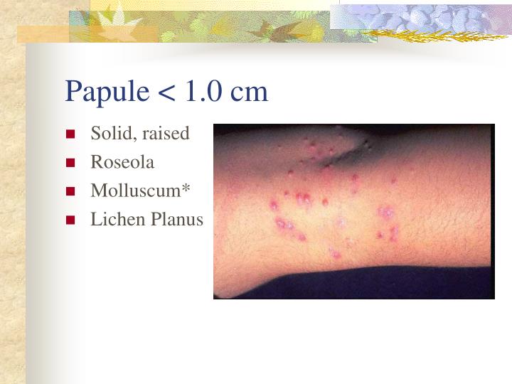 PPT - Rashes and the School Nurse PowerPoint Presentation - ID:2777002