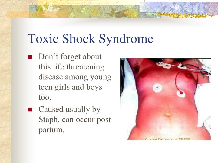 PPT - Rashes and the School Nurse PowerPoint Presentation - ID:2777002