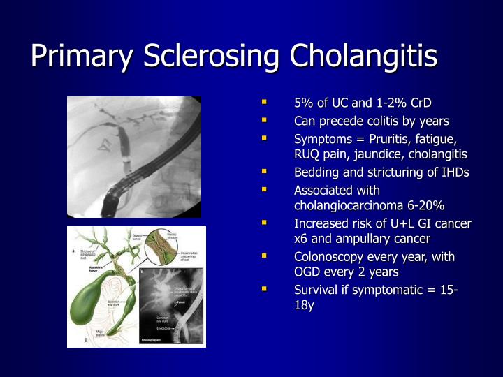 PPT - Extra GI Manifestations of IBD PowerPoint Presentation - ID:2777829