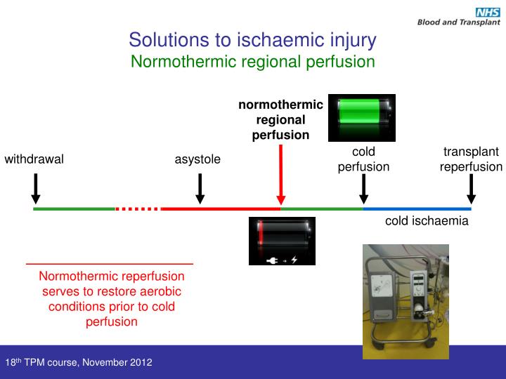 PPT - Maastricht Classification of DCD PowerPoint Presentation - ID:2778510