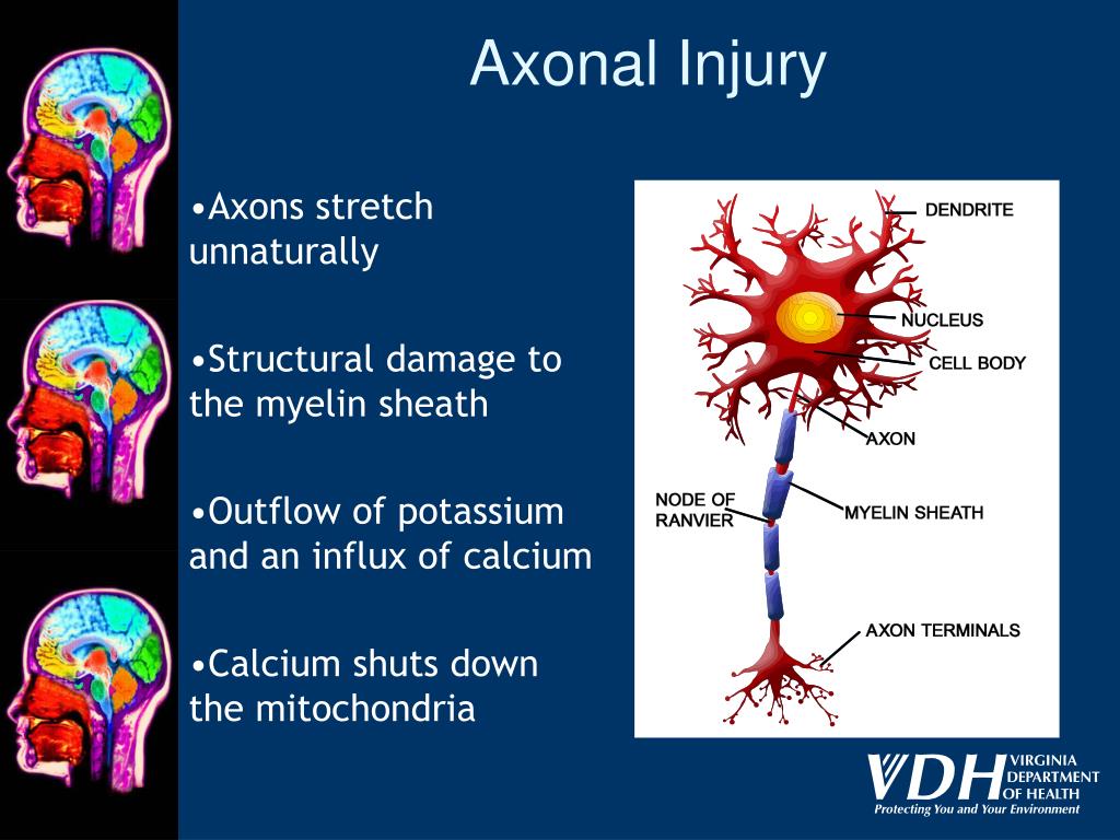 PPT - Heather Funkhouser Board, MPH Injury Prevention Program Office of ...
