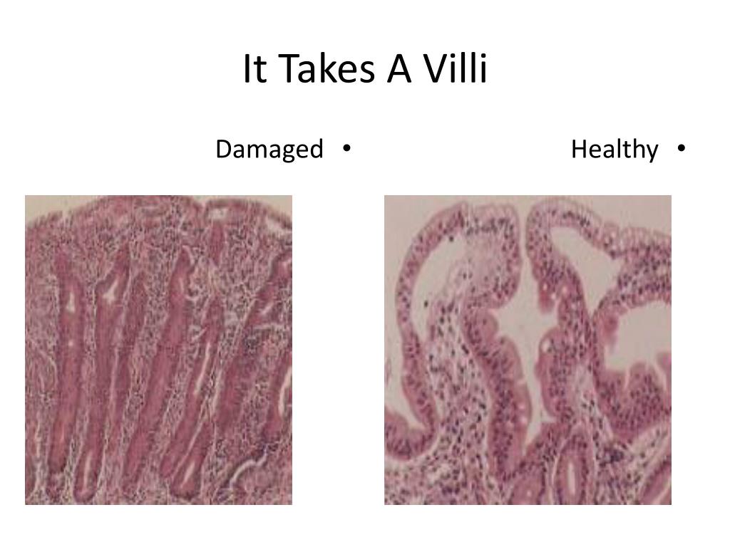PPT - Case scenario: A 36 years old woman with chronic intermittent ...