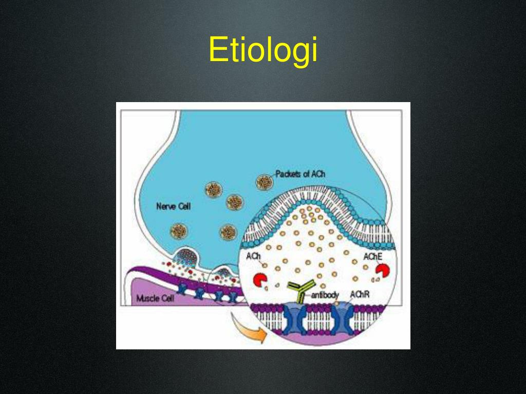 PPT - Albert Hietala, specialistläk, med dr Neurologen Sahlgrenska ...
