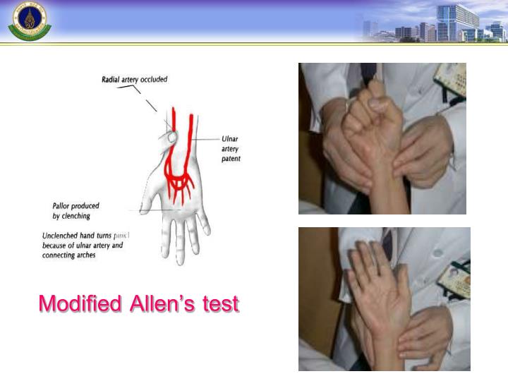 PPT - Arterial Blood Gas Interpretation PowerPoint Presentation - ID ...