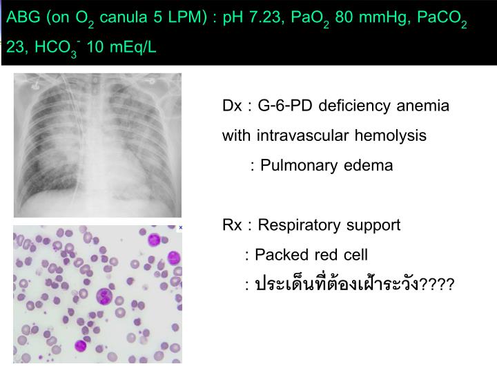 PPT - Arterial Blood Gas Interpretation PowerPoint Presentation - ID ...