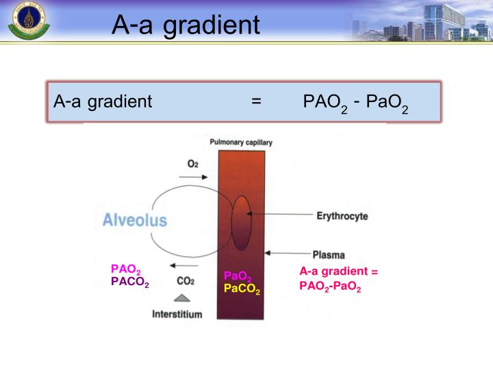 PPT - Arterial Blood Gas Interpretation PowerPoint Presentation - ID ...