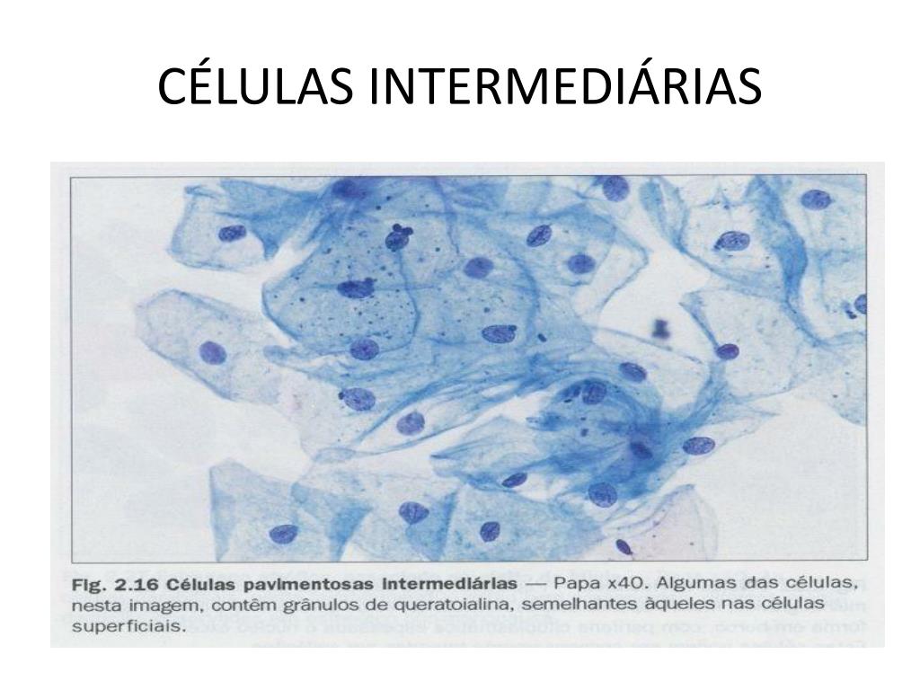 PPT - ELEMENTOS CELULARES EPITELIAIS PRESENTES NO ESFREGAÇO PowerPoint ...