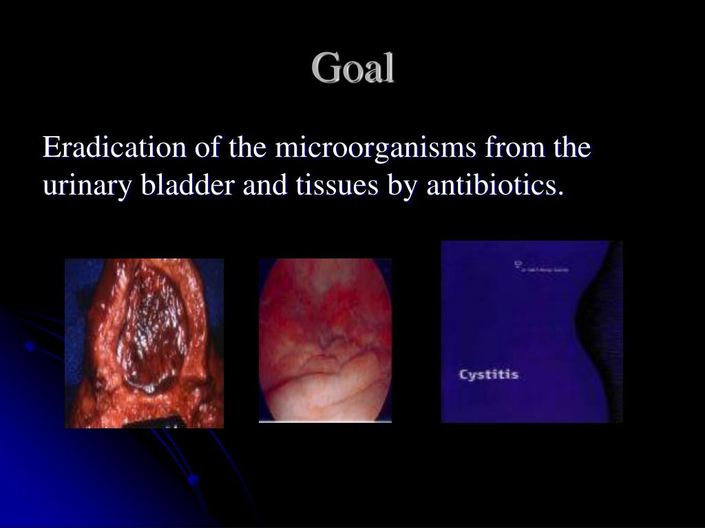 PPT - Treatment of urinary tract infections PowerPoint Presentation ...