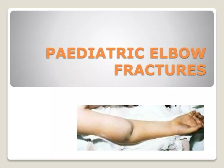PPT - PAEDIATRIC ELBOW FRACTURES PowerPoint Presentation, free download ...