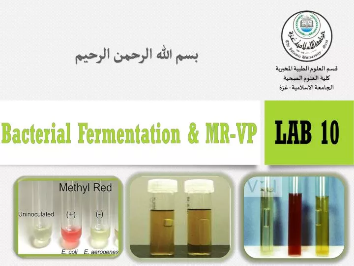 PPT - Bacterial Fermentation PowerPoint Presentation, free download ...