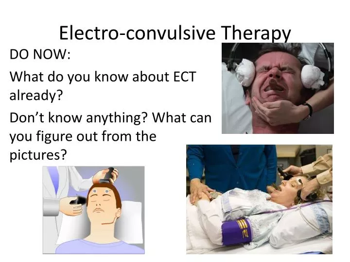 PPT - Electro-convulsive Therapy PowerPoint Presentation, free download ...