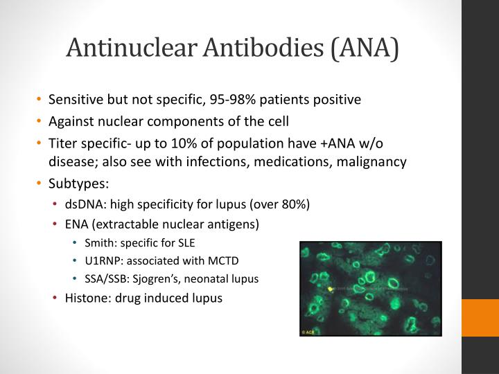 PPT - Overview of Systemic Lupus Erythematosus PowerPoint Presentation ...
