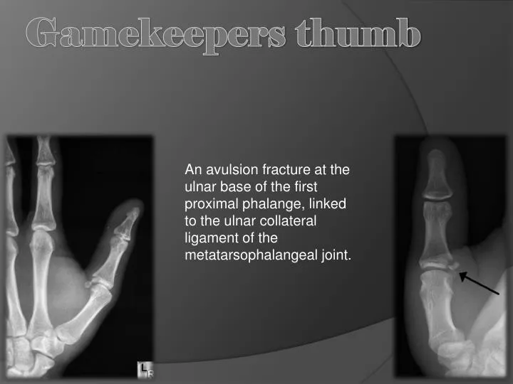 PPT - Gamekeepers thumb PowerPoint Presentation, free download - ID:2810585