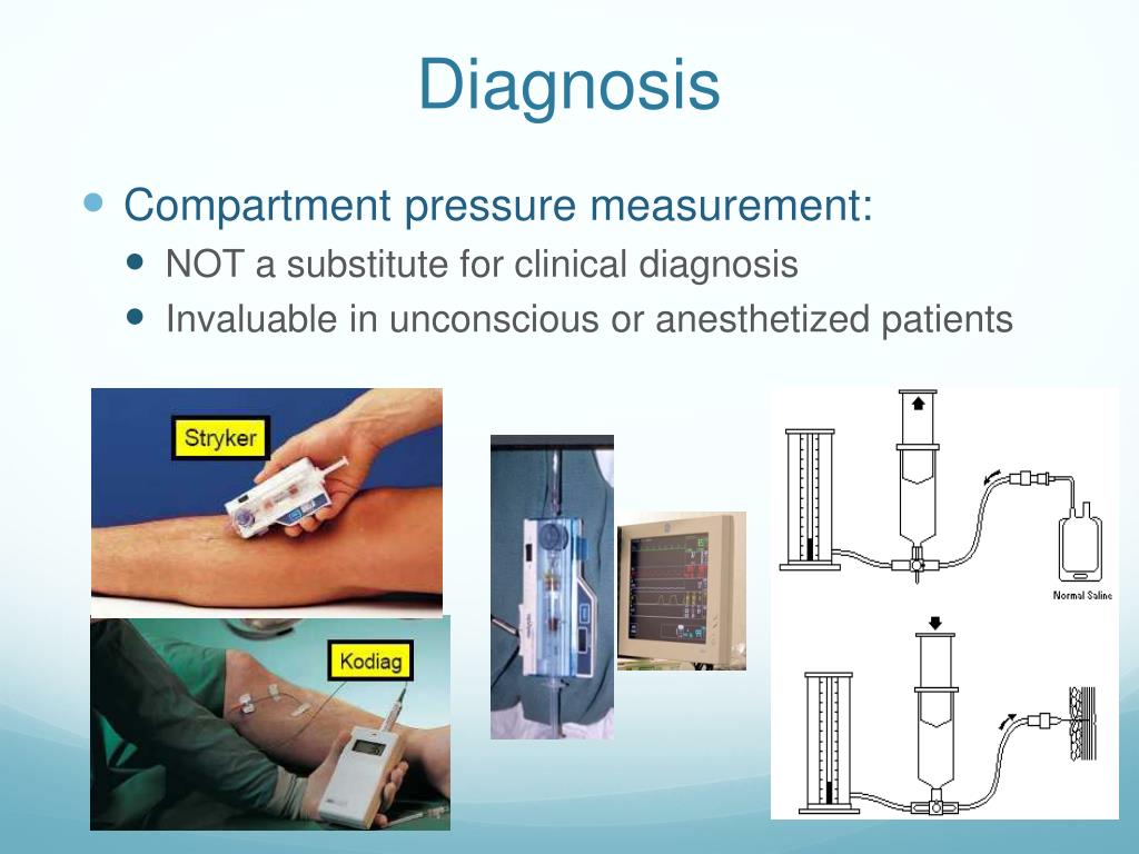 Compartment Syndrome Clinical Features Emergency Mana