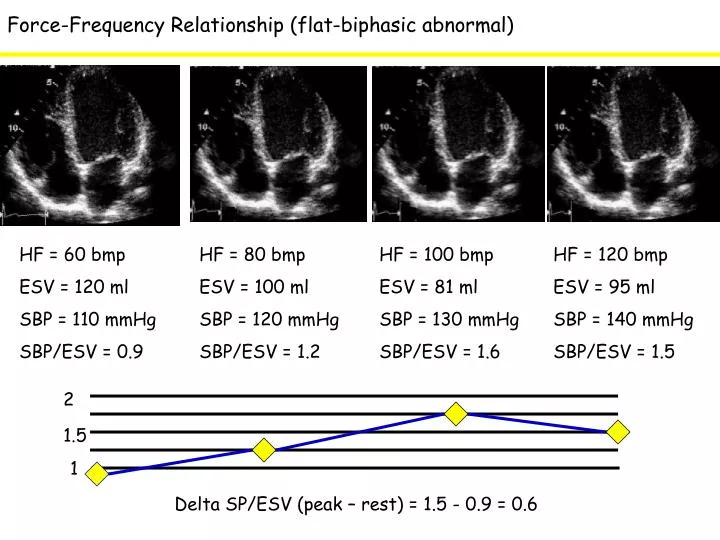 PPT - Force-Frequency Relationship (flat-biphasic abnormal) PowerPoint ...