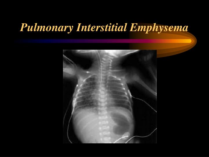 PPT - Reading a Neonatal Chest X-ray PowerPoint Presentation - ID:2827363