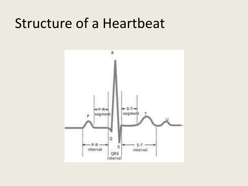 PPT - Circulatory System PowerPoint Presentation, free download - ID ...