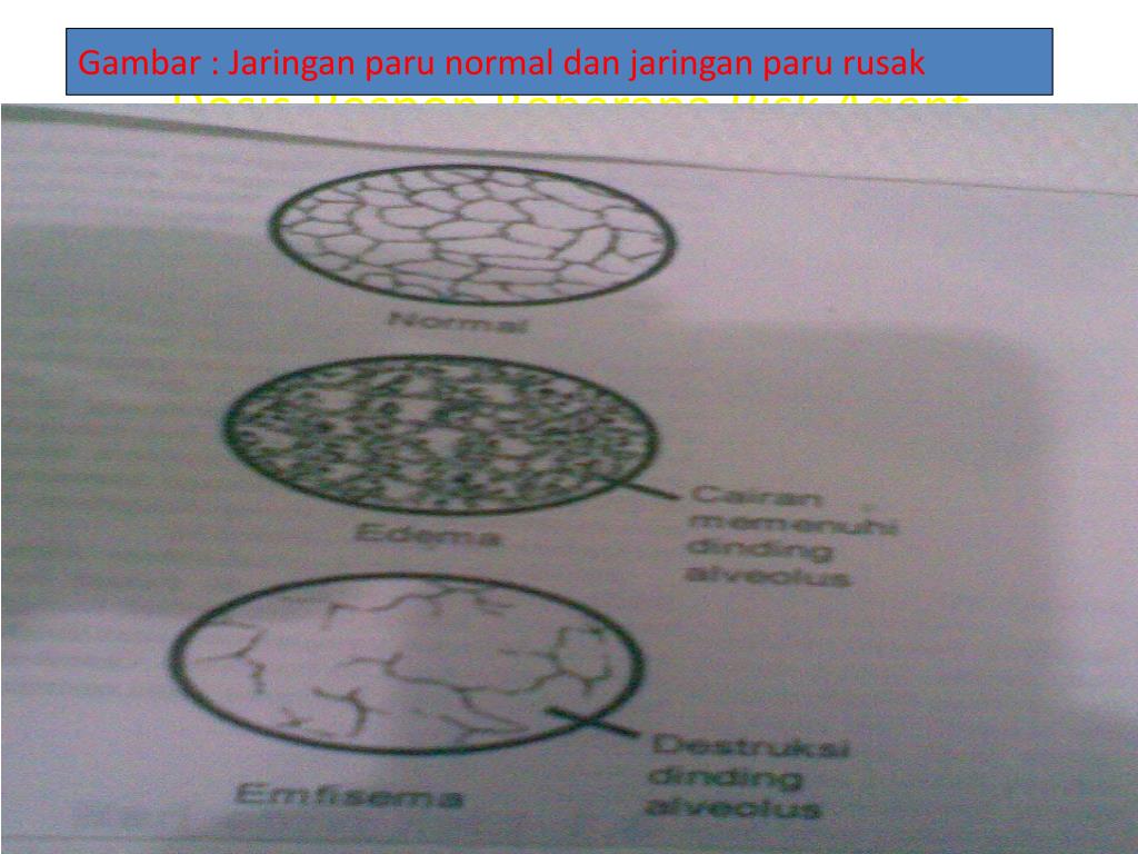 PPT - Gambar:difusi toksin ke dalam sel dengan menggunakan molekul ...