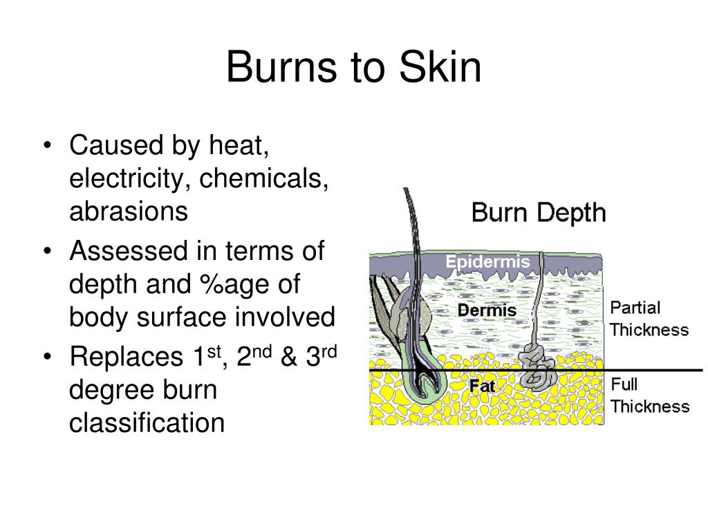 PPT - The Skin in Health & Disease PowerPoint Presentation, free ...