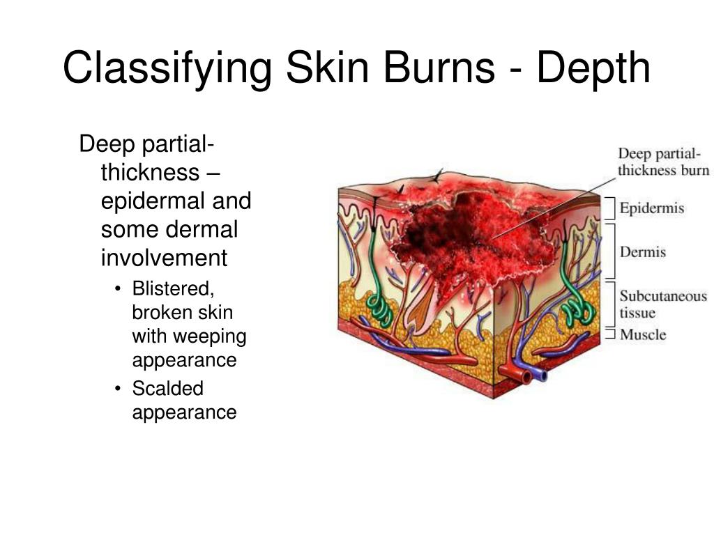 PPT - The Skin in Health & Disease PowerPoint Presentation, free ...