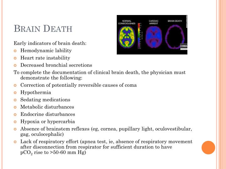 PPT - Organ Transplantation PowerPoint Presentation - ID:2835386