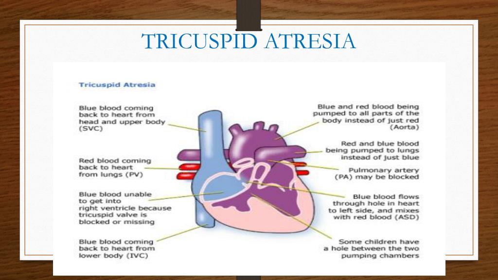 PPT - CONGENITAL HEART DISEASE – RIGHT TO LEFT SHUNT PowerPoint ...