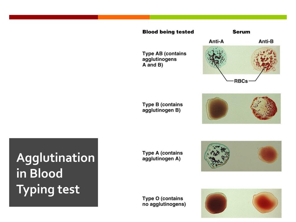 PPT - Cardiovascular System – Heart and Blood Vessels PowerPoint ...