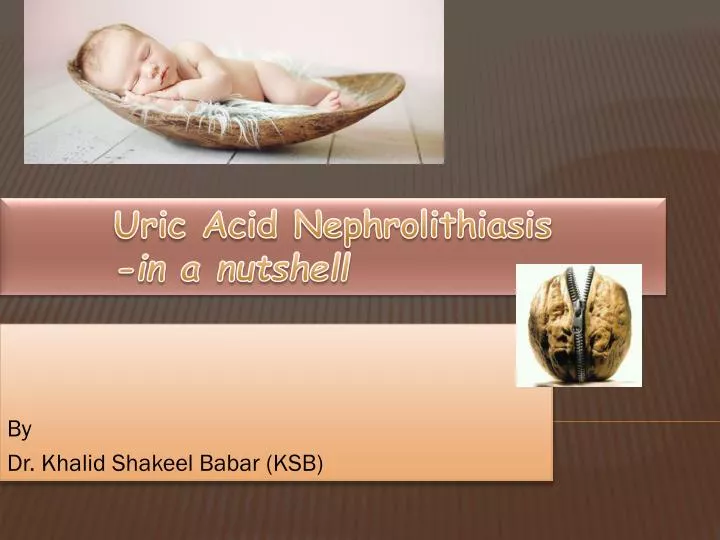 PPT - Uric Acid Nephrolithiasis -in a nutshell PowerPoint Presentation ...